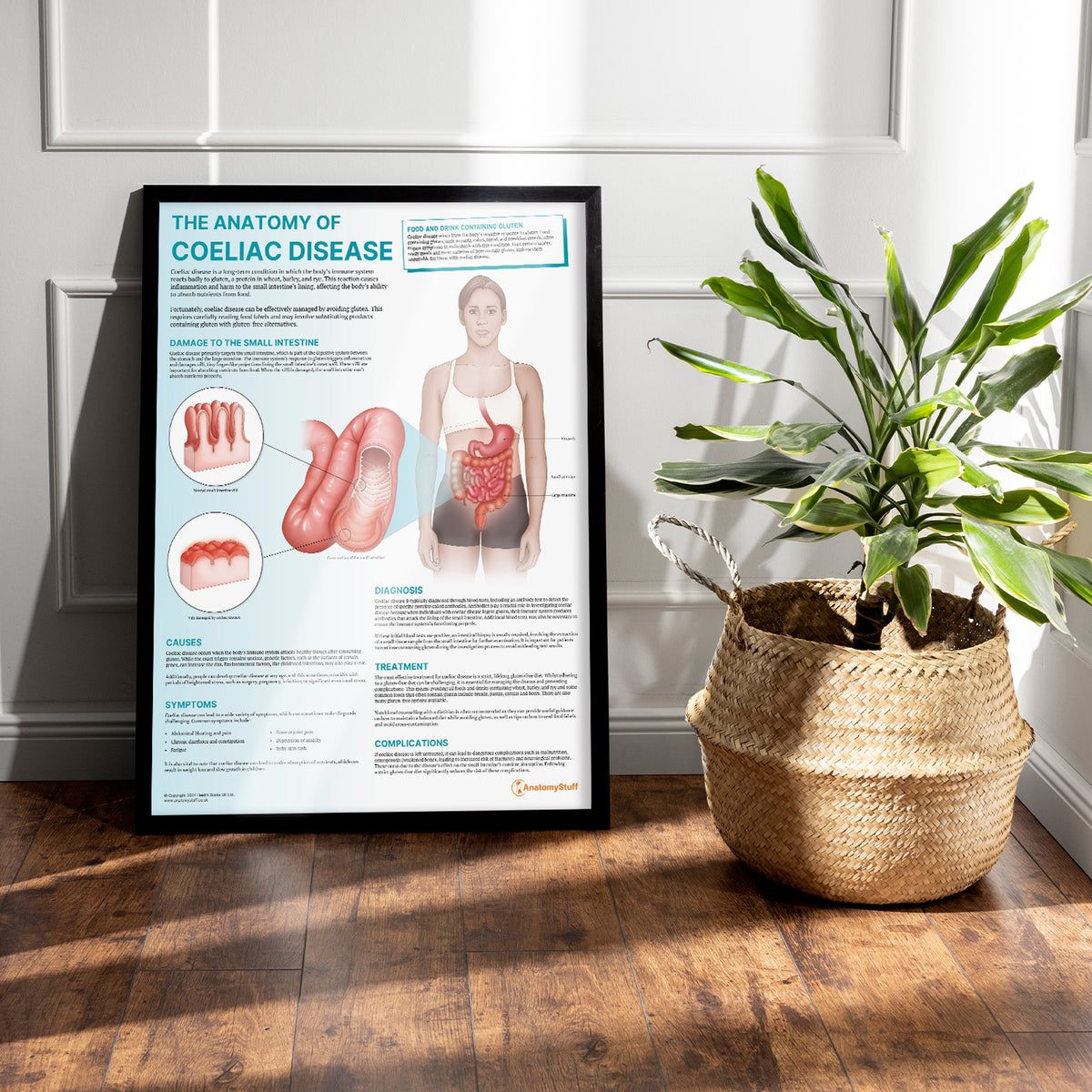 The Anatomy of Coeliac Disease Chart | Digestive Health Poster ...