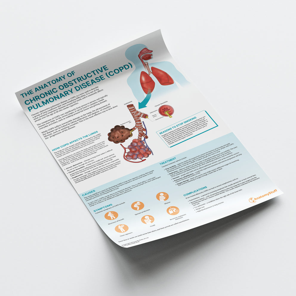 The Anatomy of COPD Chart | Chronic Lung Disease Poster – AnatomyStuff