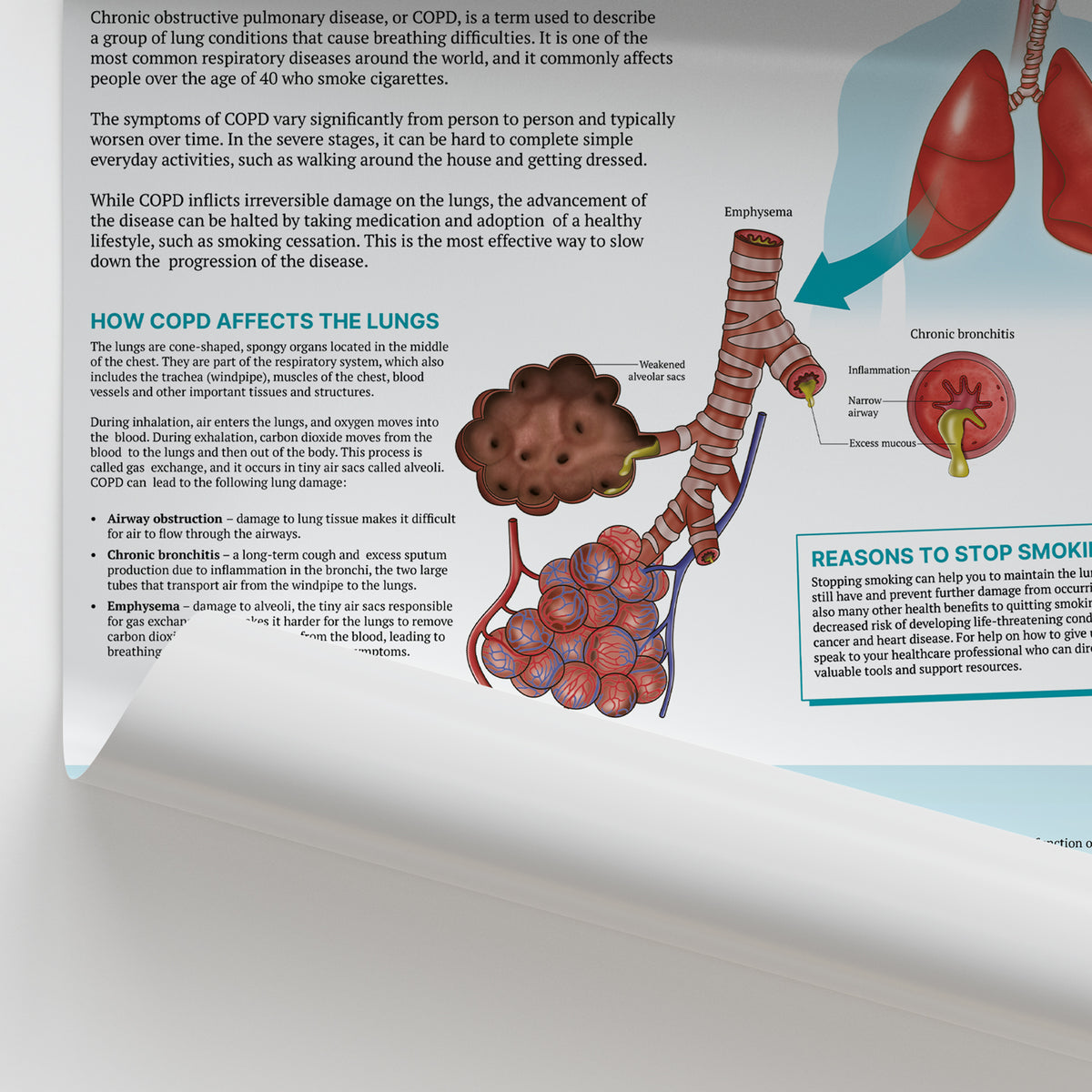 The Anatomy of COPD Chart | Chronic Lung Disease Poster – AnatomyStuff