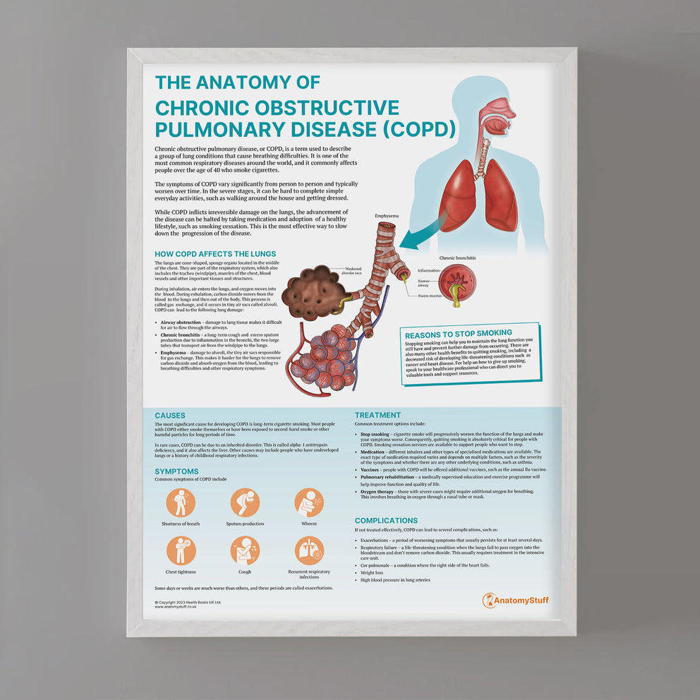 The Anatomy of COPD Chart | Chronic Lung Disease Poster – AnatomyStuff