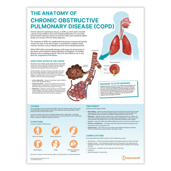 The Anatomy of COPD Chart | Chronic Lung Disease Poster – AnatomyStuff