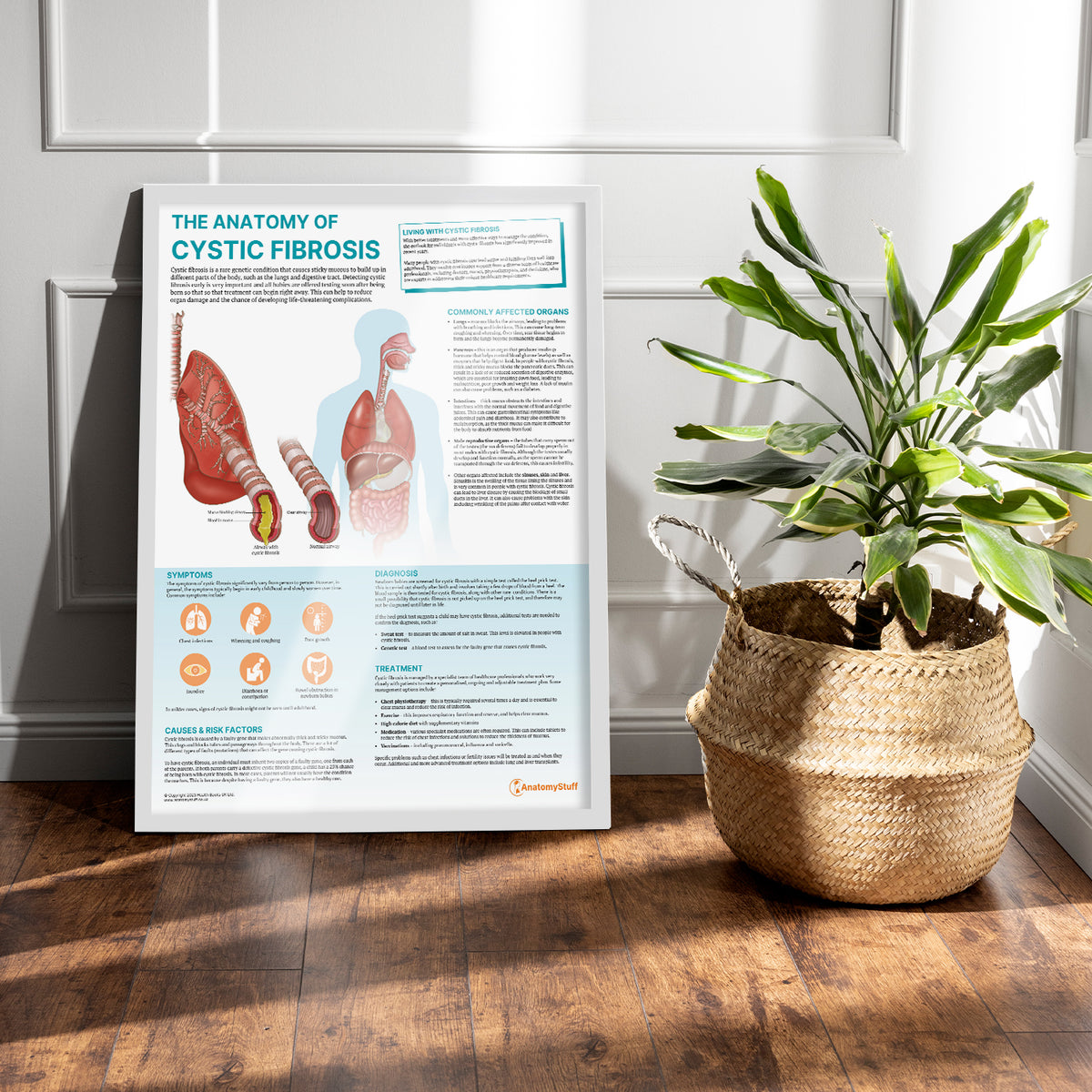 The Anatomy of Cystic Fibrosis Chart | Respiratory Health Poster ...