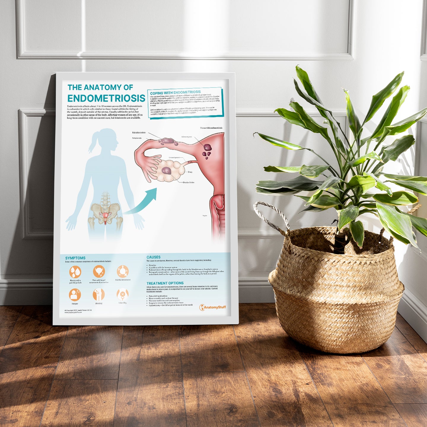 Anatomy of Endometriosis Chart | Causes, Symptoms & Treatment Poster ...