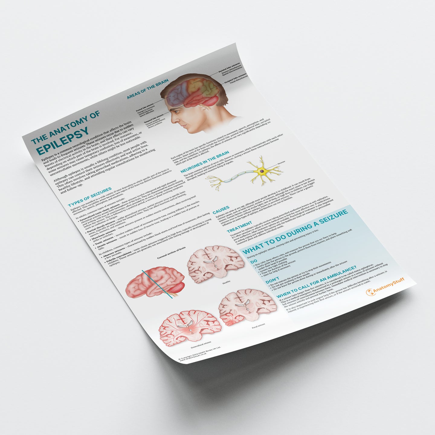 Anatomy of Epilepsy Chart | Seizure Types and Brain Anatomy Poster ...