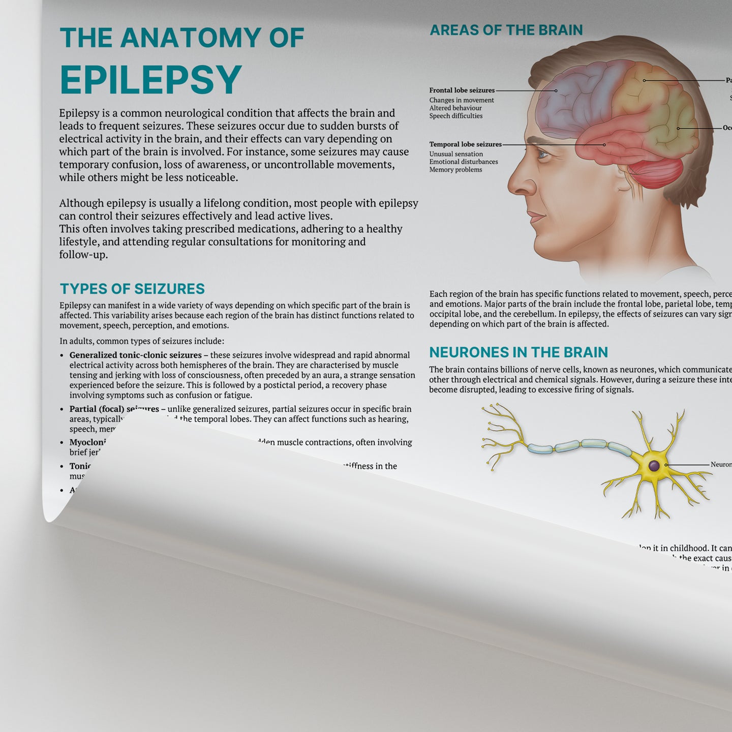 Anatomy of Epilepsy Chart | Seizure Types and Brain Anatomy Poster ...