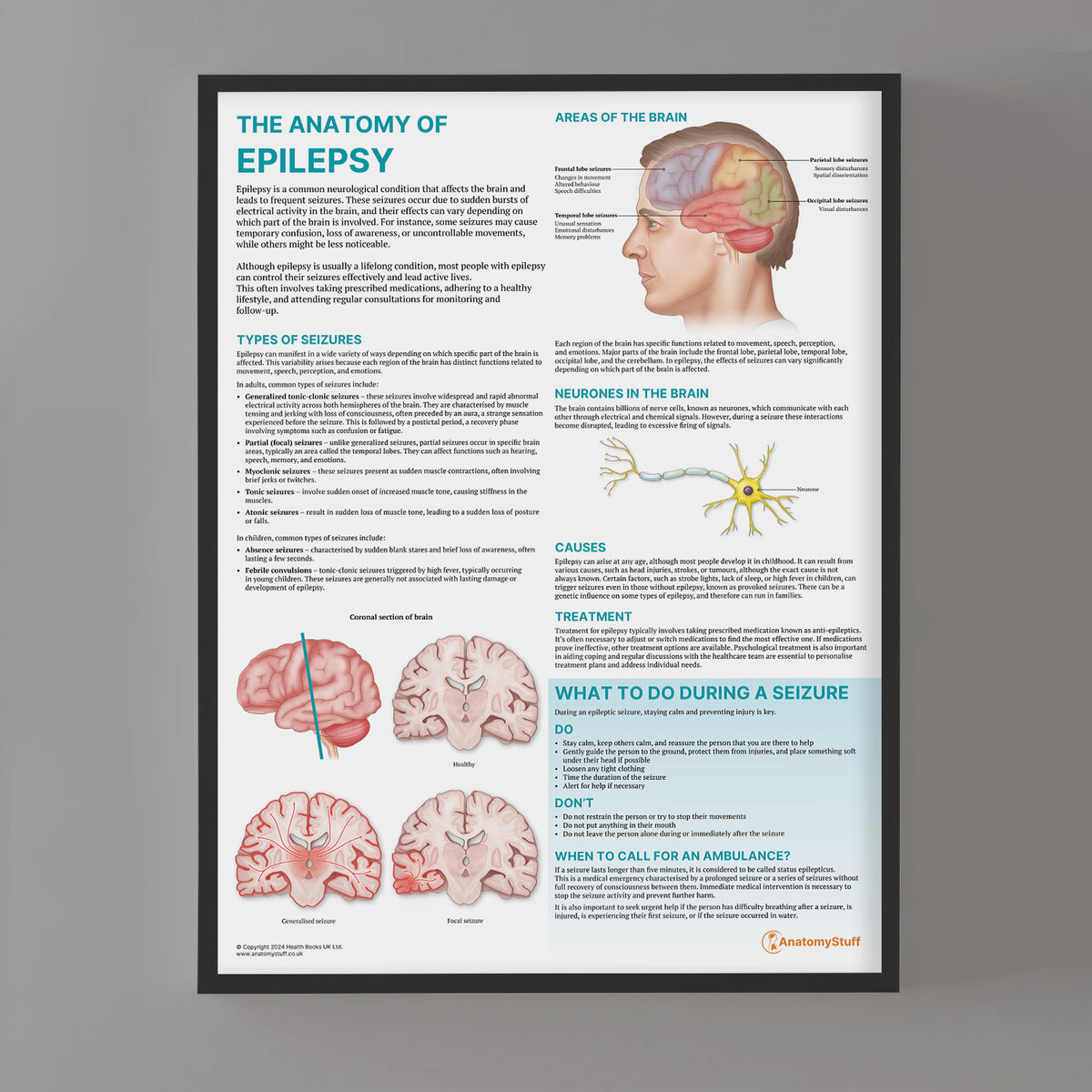 Anatomy of Epilepsy Chart | Seizure Types and Brain Anatomy Poster ...