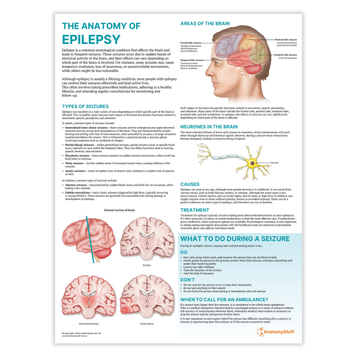 Anatomy of Epilepsy Chart | Seizure Types and Brain Anatomy Poster ...