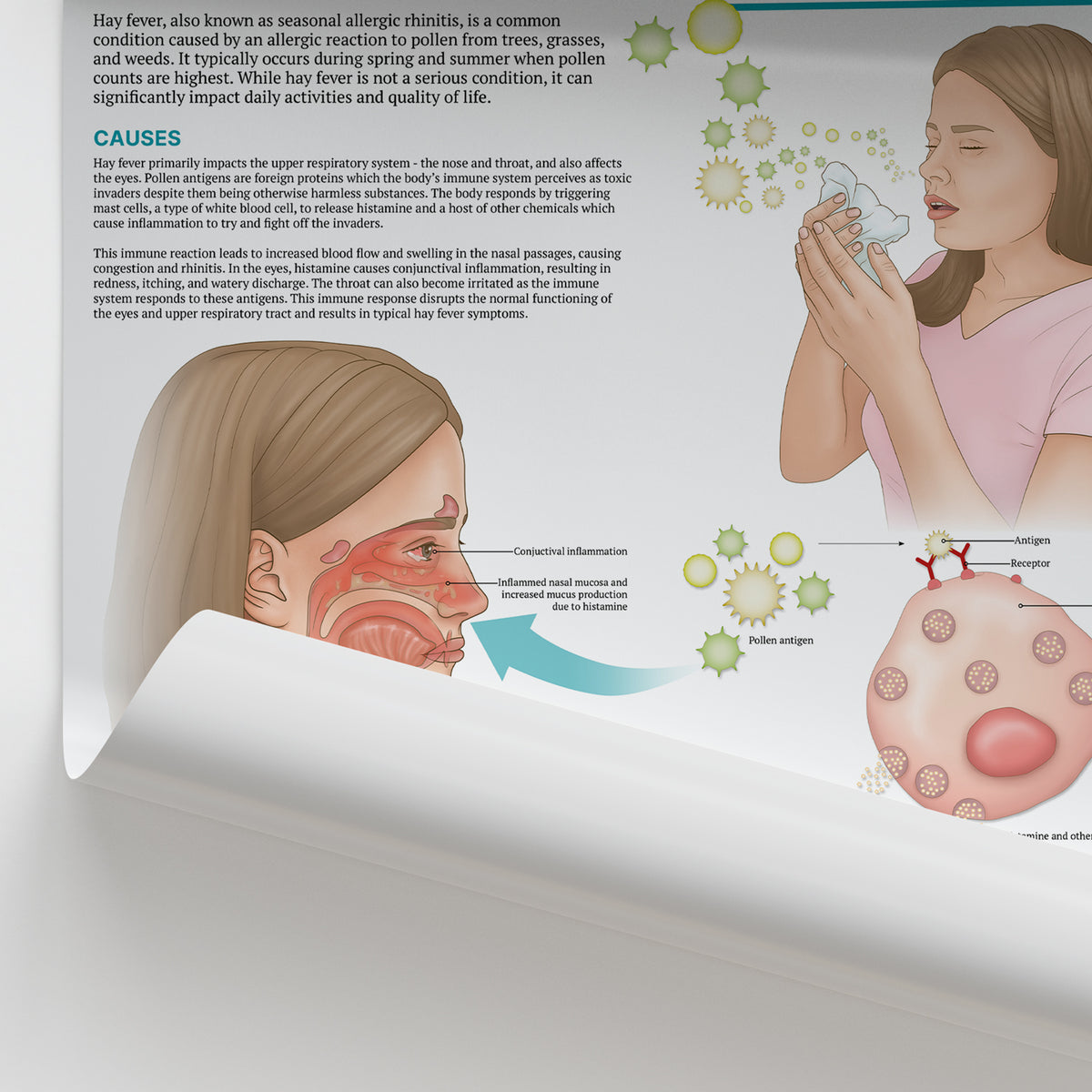 Hay Fever Anatomy Poster | Seasonal Allergy Chart | AnatomyStuff