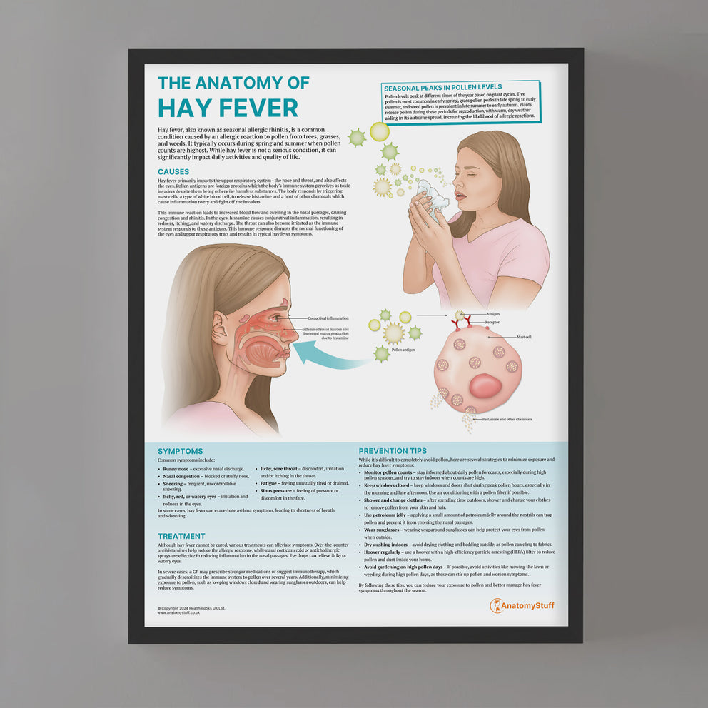 Hay Fever Anatomy Poster | Seasonal Allergy Chart | AnatomyStuff