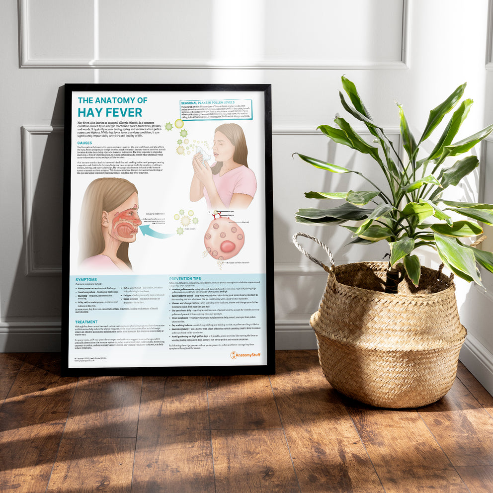 Hay Fever Anatomy Poster | Seasonal Allergy Chart | AnatomyStuff