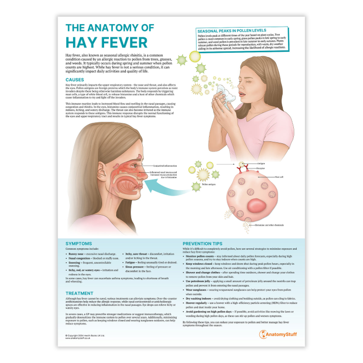 Hay Fever Anatomy Poster | Seasonal Allergy Chart | AnatomyStuff