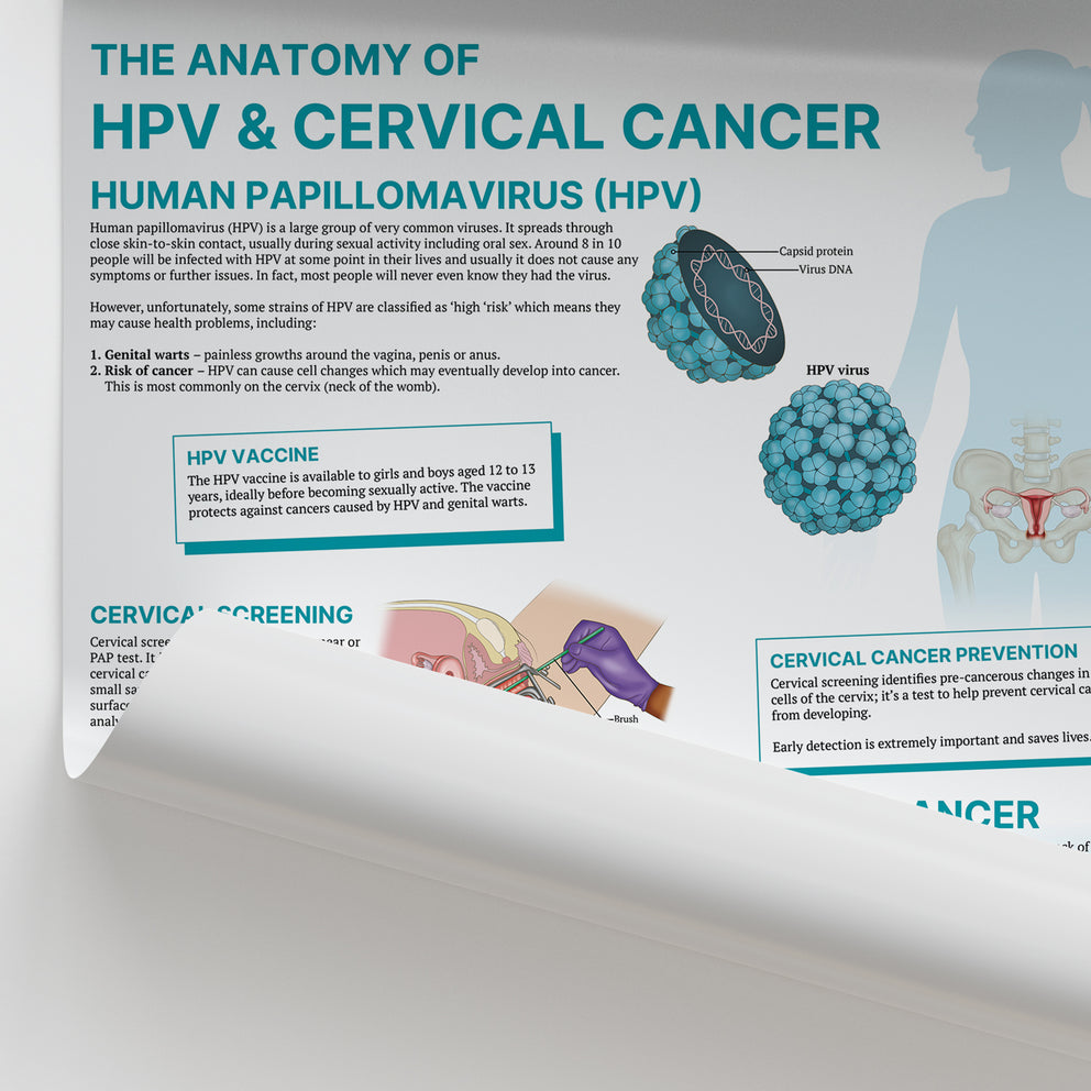 Anatomy of HPV & Cervical Cancer Poster | Female Reproductive Chart ...