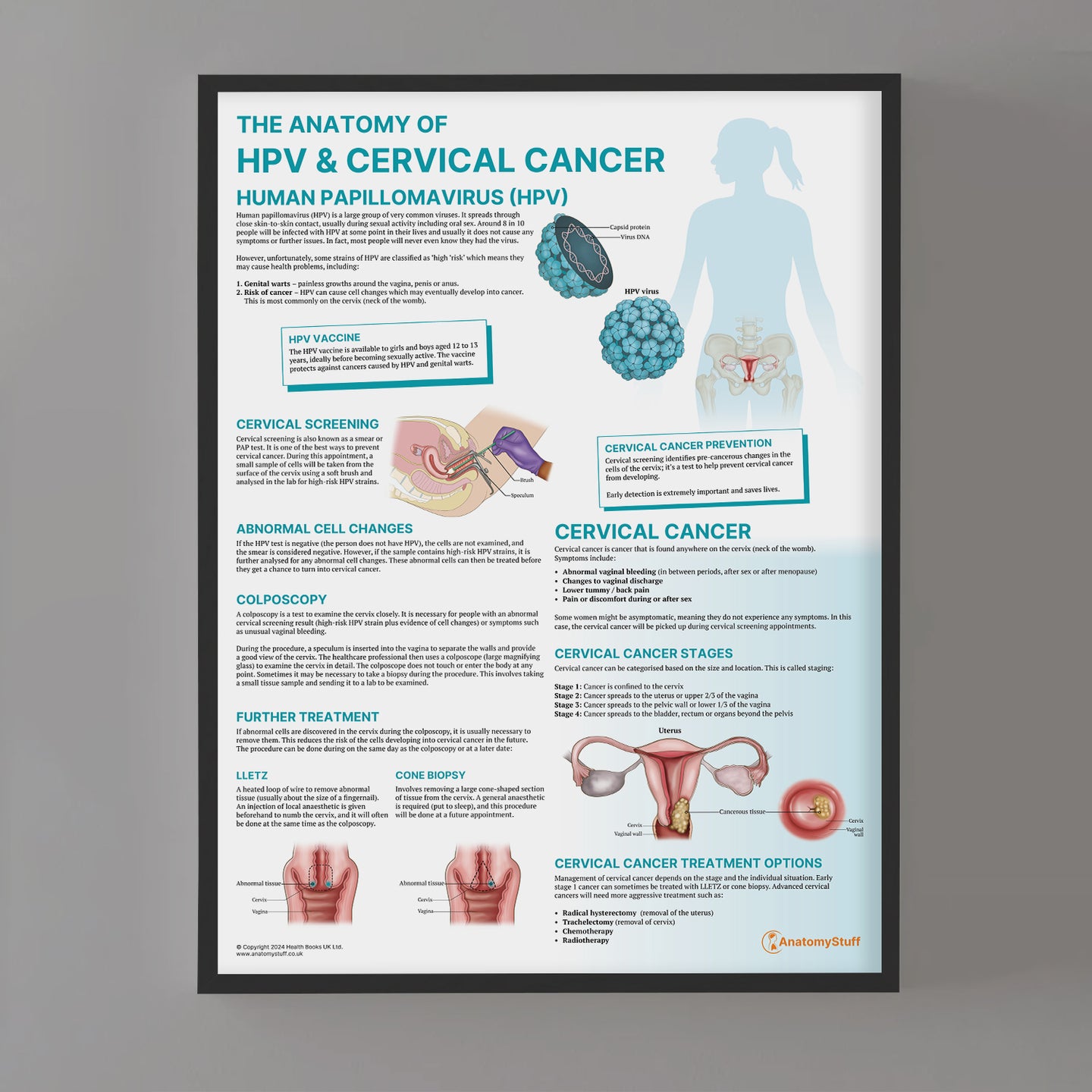 Anatomy of HPV & Cervical Cancer Poster | Female Reproductive Chart ...