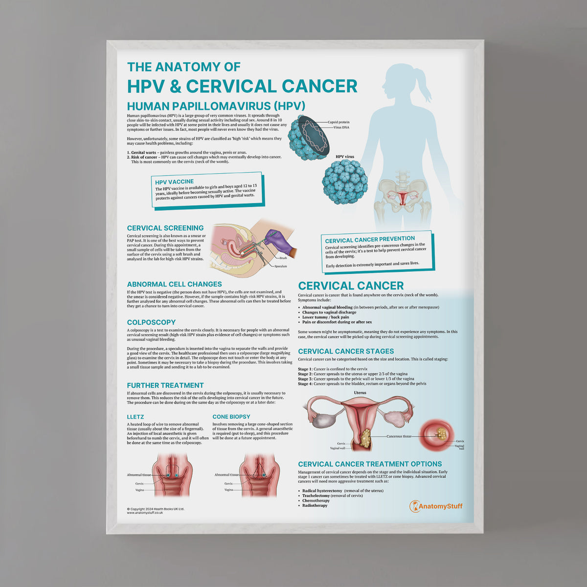 Anatomy of HPV & Cervical Cancer Poster | Female Reproductive Chart ...