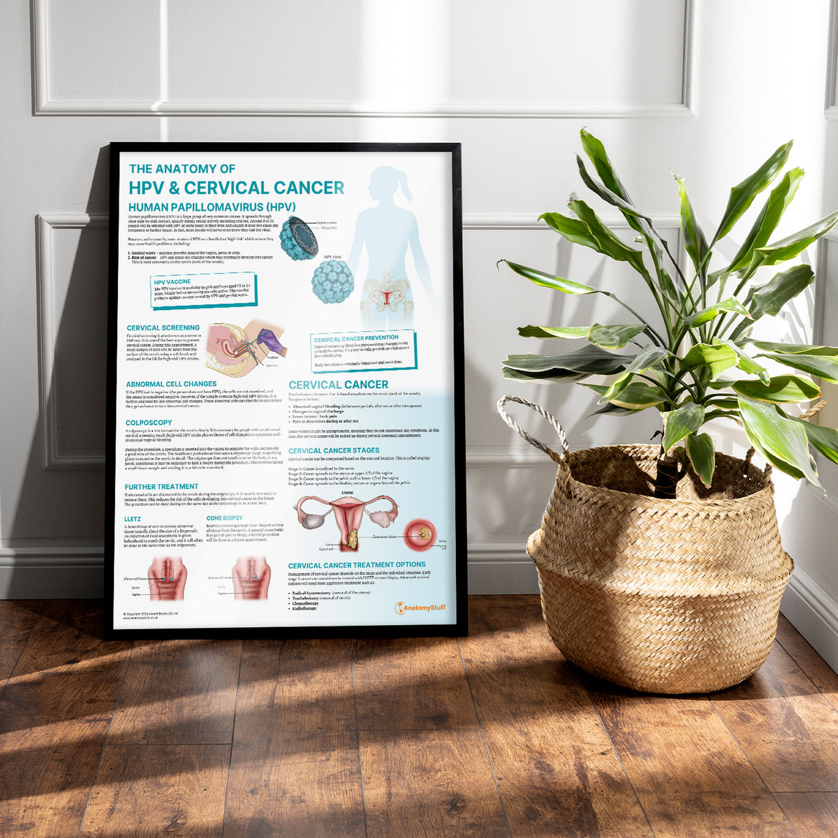 Anatomy of HPV & Cervical Cancer Poster | Female Reproductive Chart ...