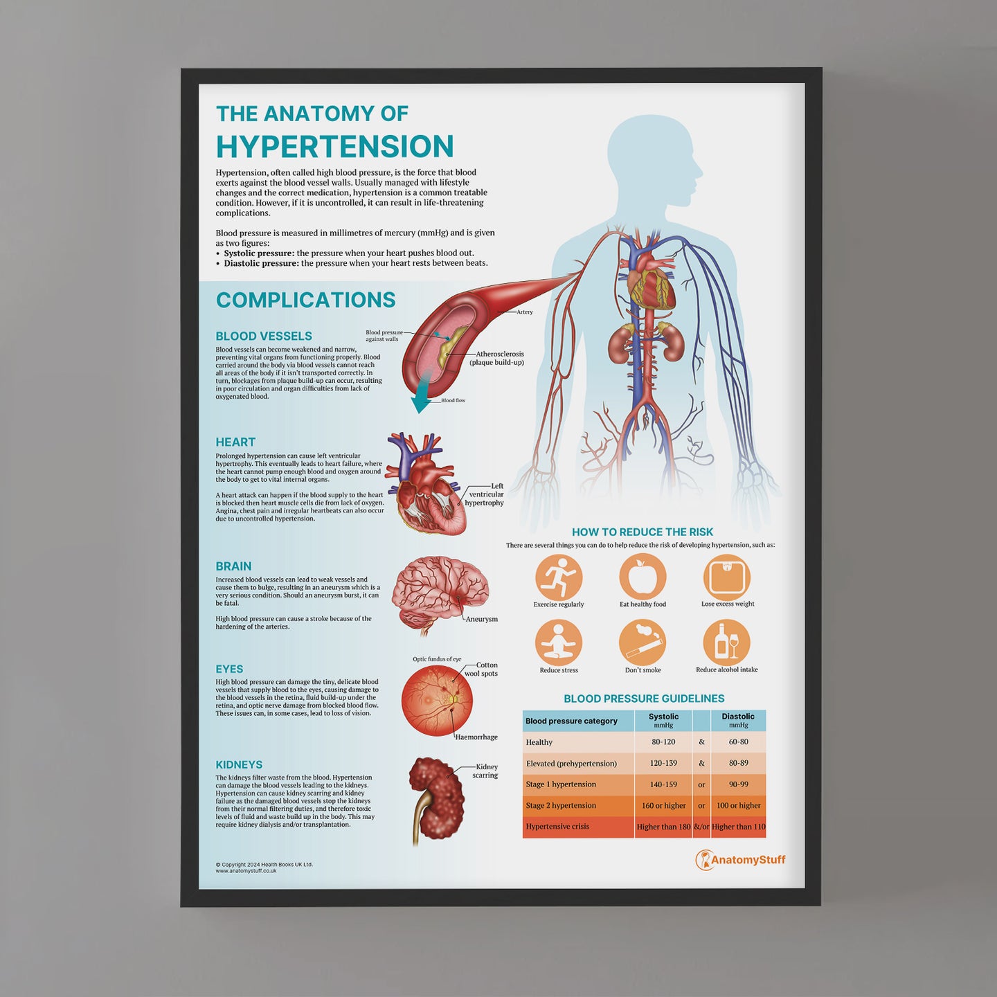 The Anatomy of Hypertension Poster | Blood Pressure Education ...