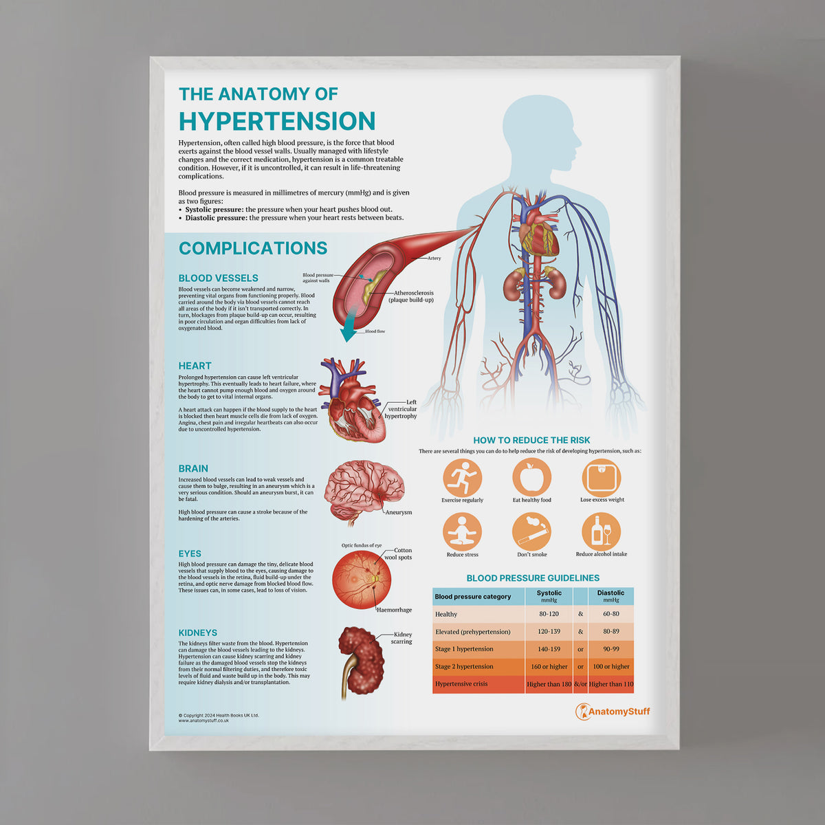 The Anatomy Of Hypertension Poster Blood Pressure Education