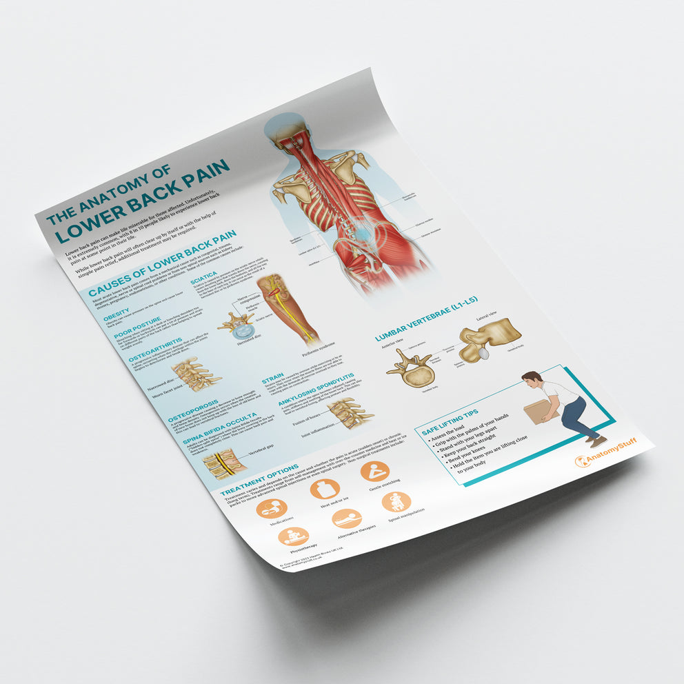 The Anatomy of Lower Back Pain Poster | Patient Education Tool ...