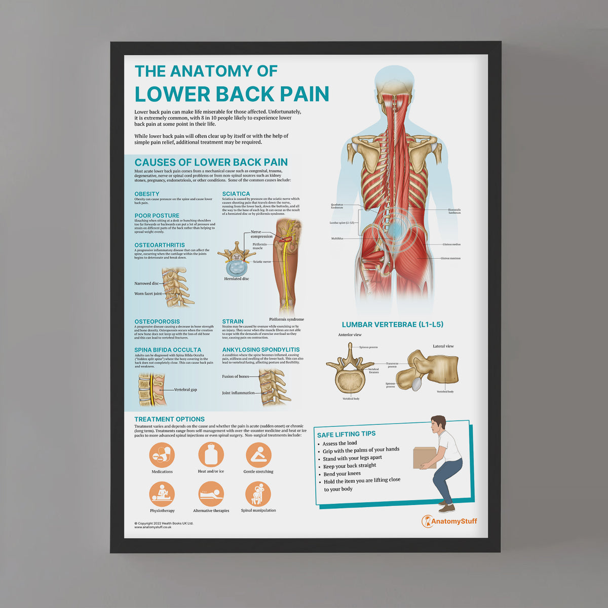 The Anatomy of Lower Back Pain Poster | Patient Education Tool ...