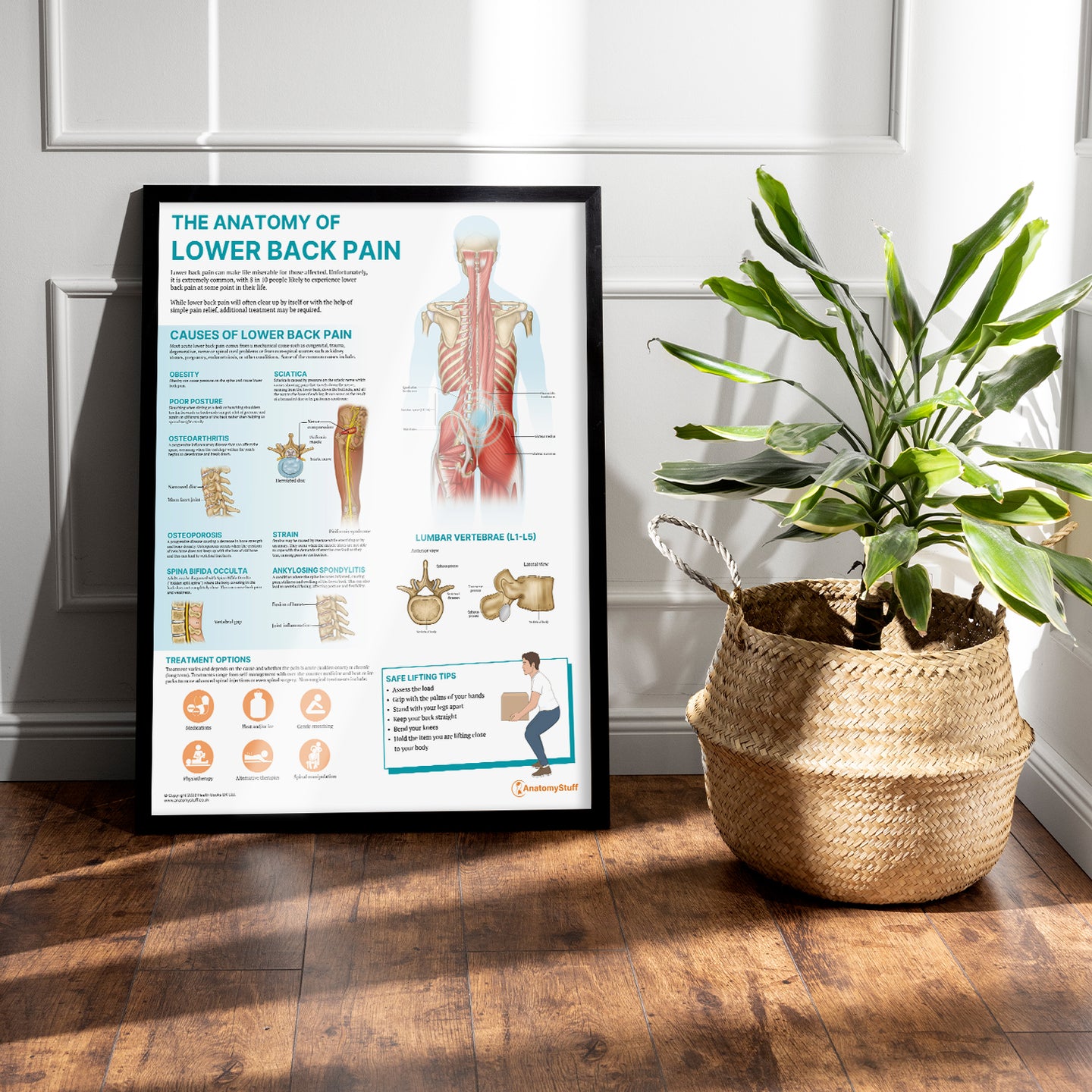 The Anatomy of Lower Back Pain Poster | Patient Education Tool ...