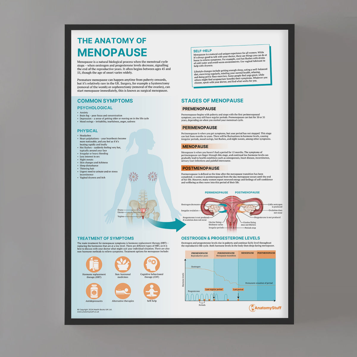 The Anatomy of Menopause Poster | Women's Health Education – AnatomyStuff