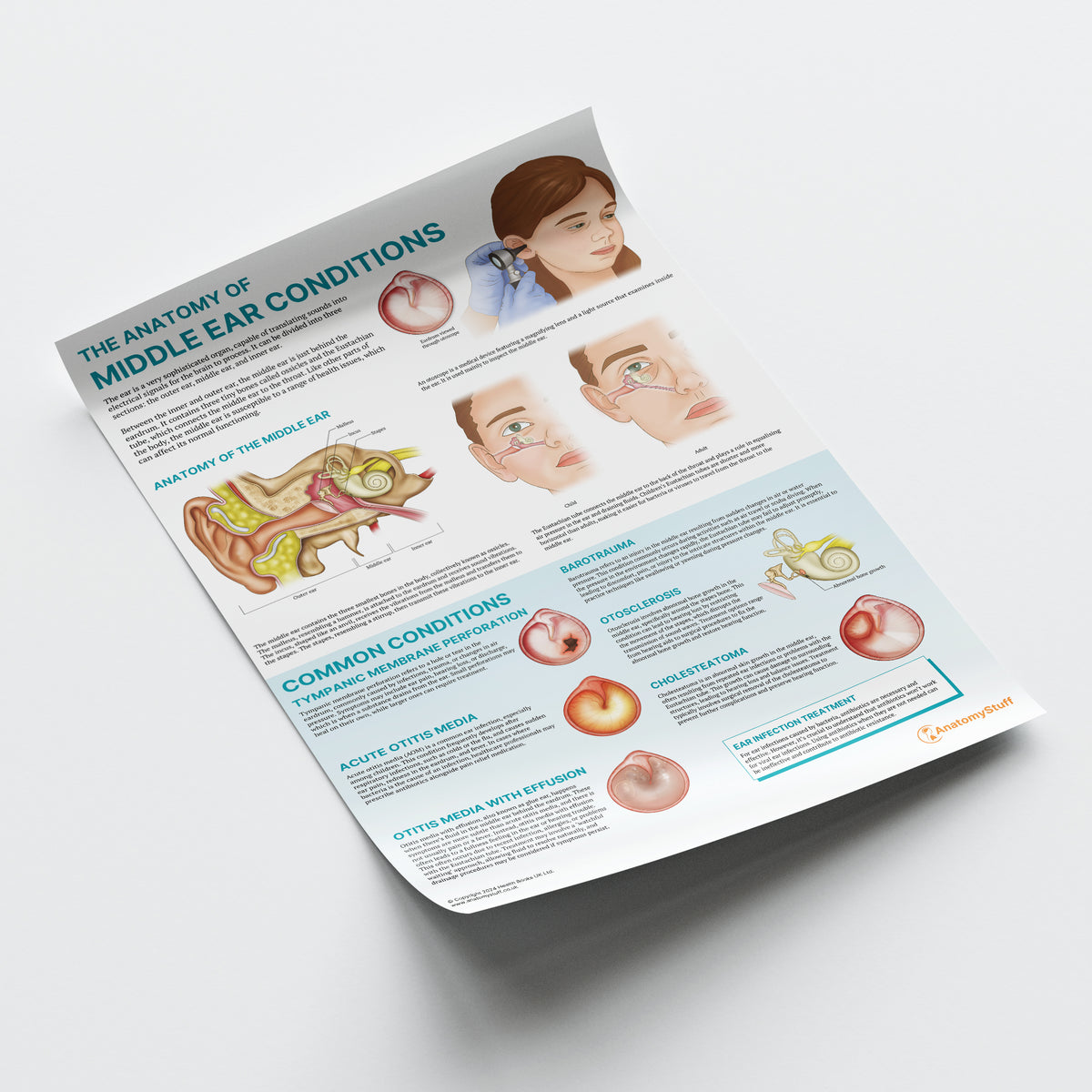 The Anatomy of Middle Ear Conditions Poster | ENT Education – AnatomyStuff