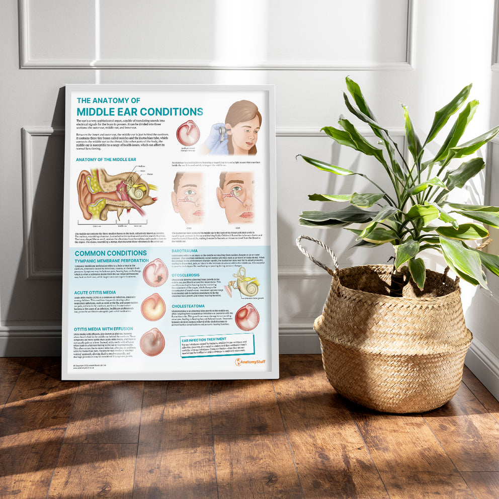 The Anatomy of Middle Ear Conditions Poster | ENT Education – AnatomyStuff