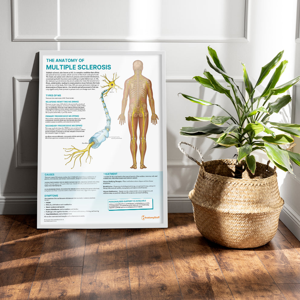 The Anatomy of Multiple Sclerosis Poster | Neurology Patient Education ...