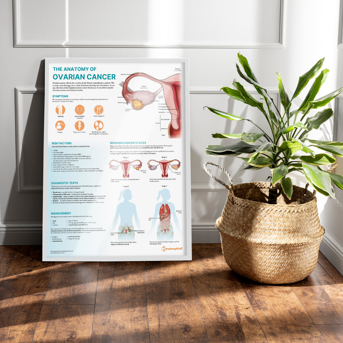 The Anatomy of Ovarian Cancer Poster | Gynaecological Cancer Chart ...