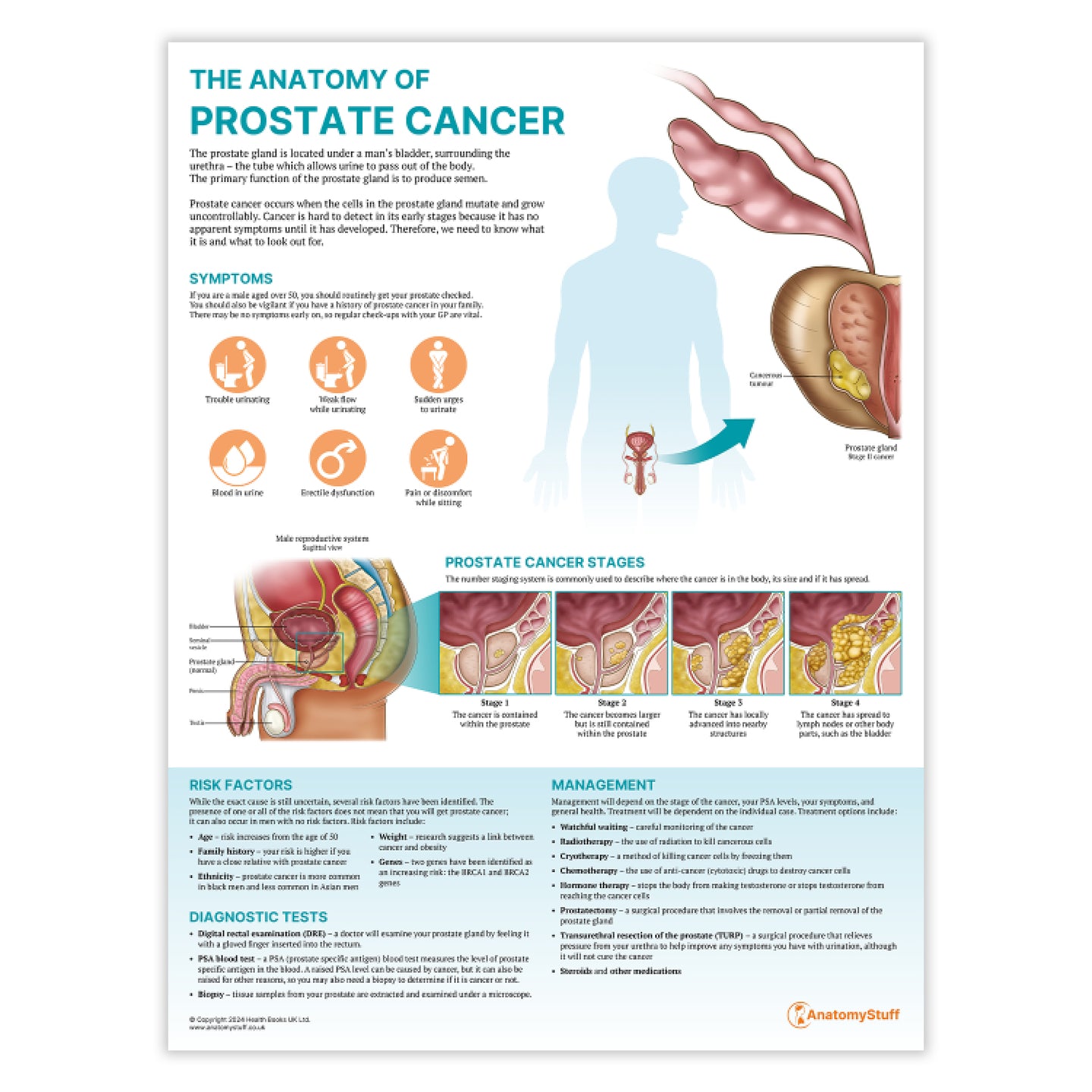 The Anatomy of Prostate Cancer Poster | Male Health Education Chart ...
