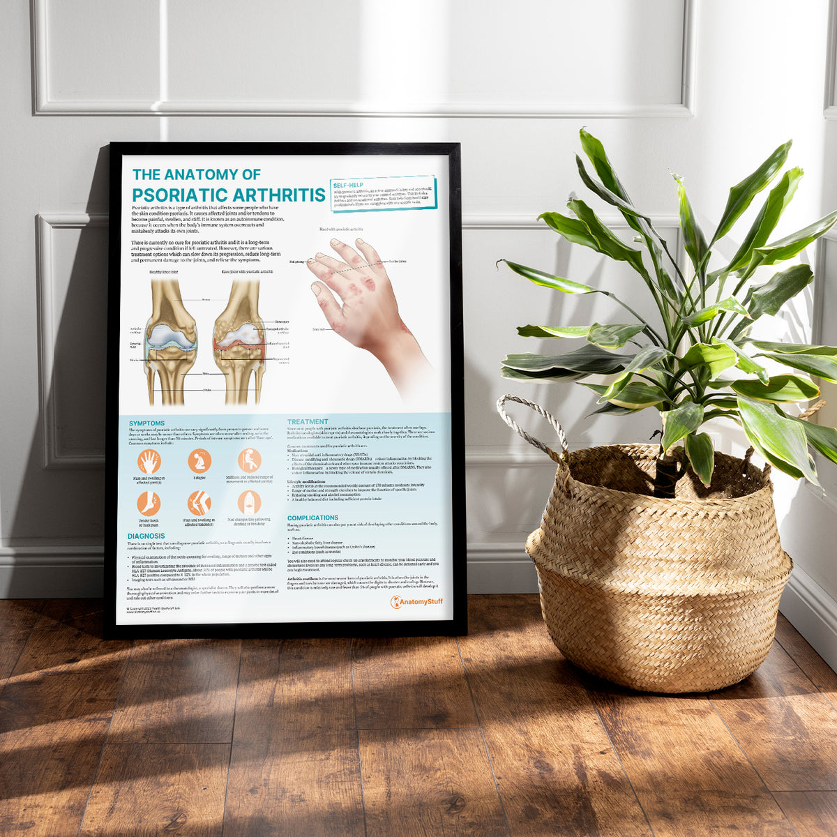 The Anatomy of Psoriatic Arthritis Poster | Joint Health & Dermatology ...