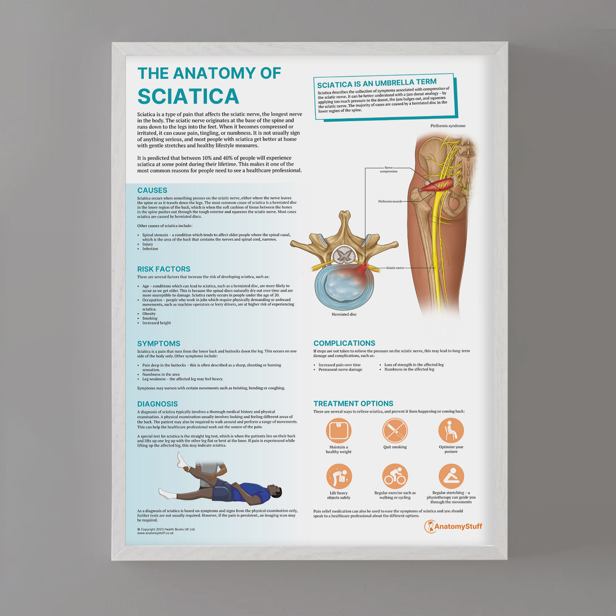 The Anatomy of Sciatica Poster | Nerve Pain & Spine Chart – AnatomyStuff