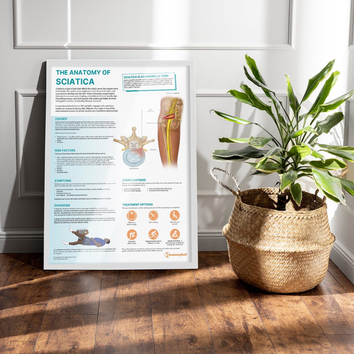 The Anatomy of Sciatica Poster | Nerve Pain & Spine Chart – AnatomyStuff