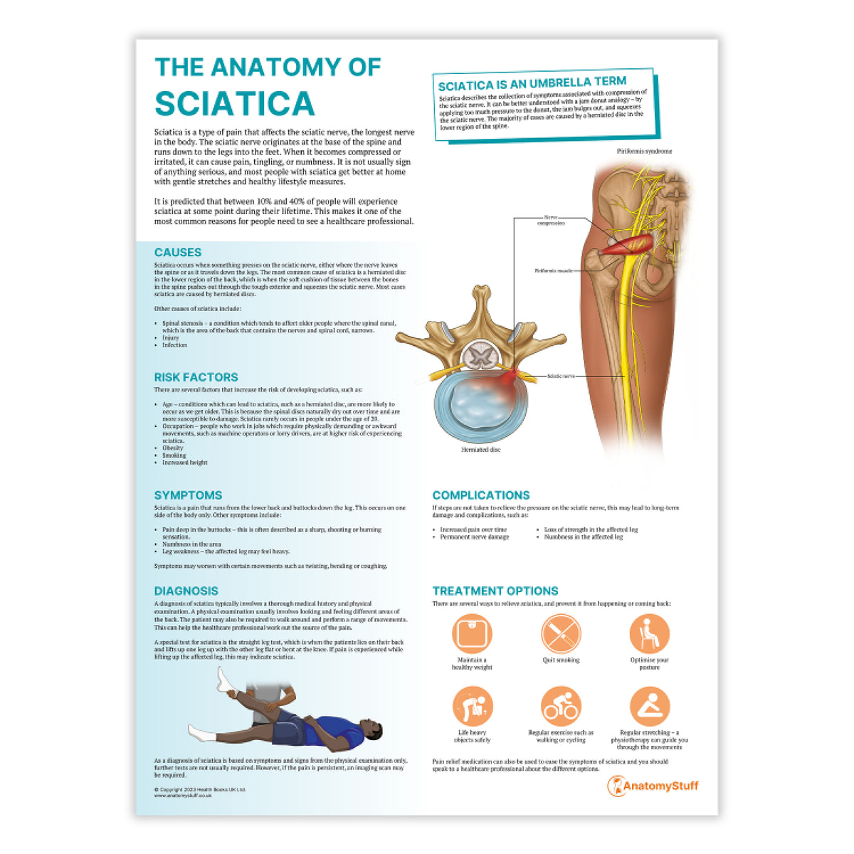 The Anatomy of Sciatica Poster | Nerve Pain & Spine Chart – AnatomyStuff