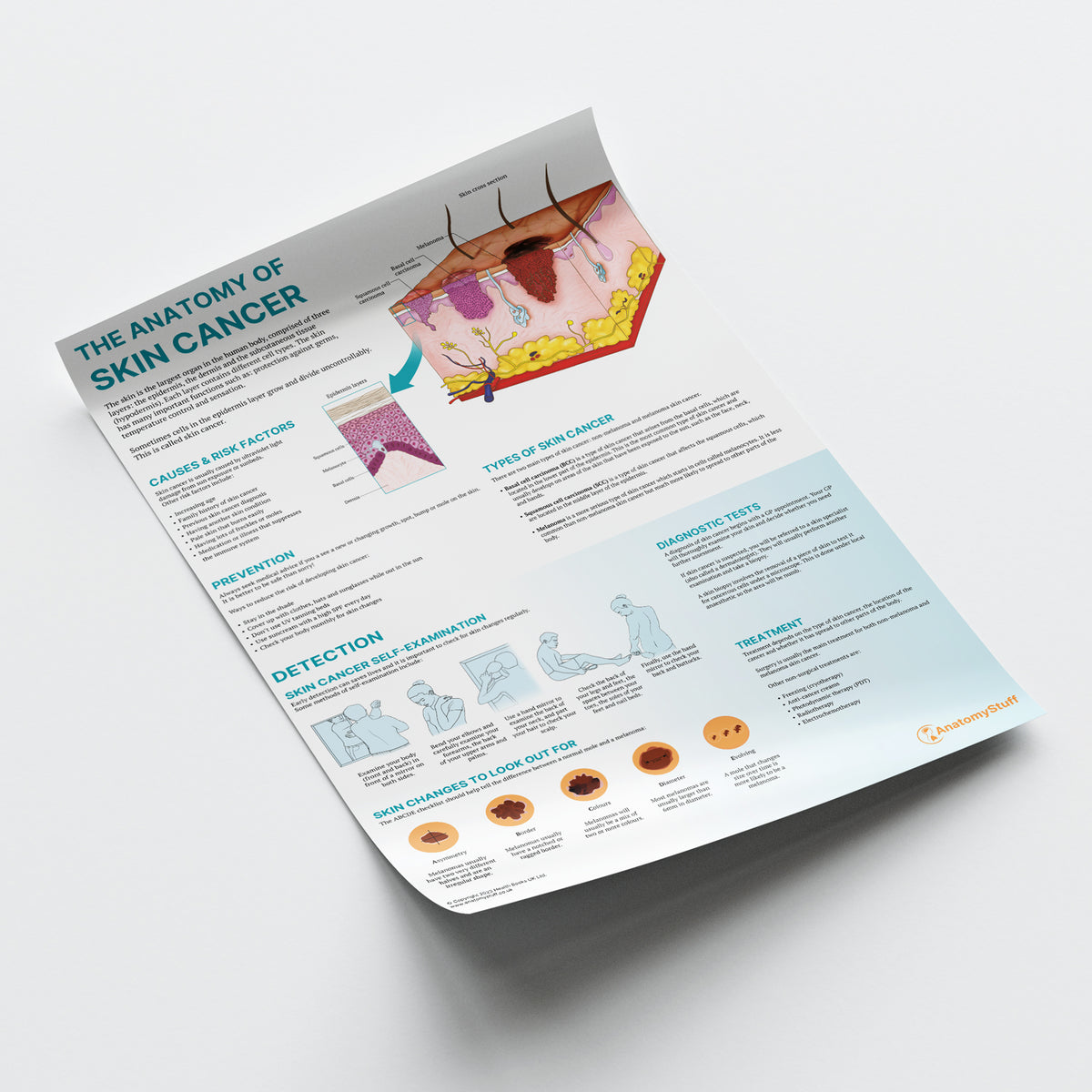 The Anatomy of Skin Cancer Chart | Dermatology Patient Education ...