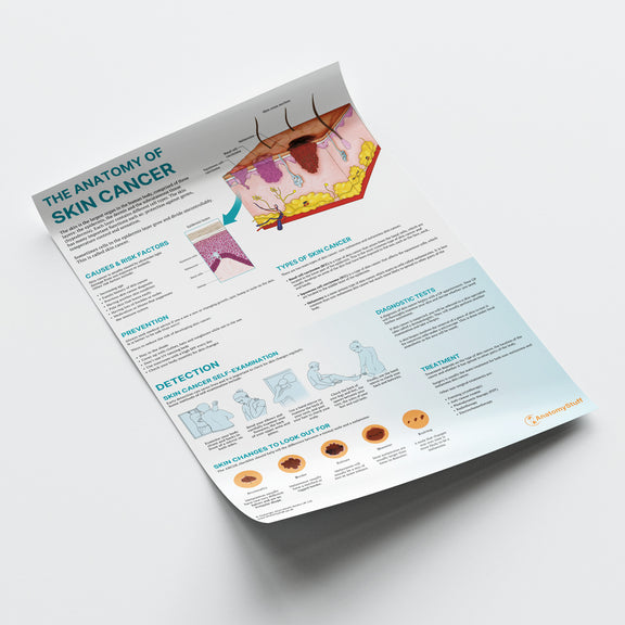 The Anatomy of Skin Cancer Chart | Dermatology Patient Education ...