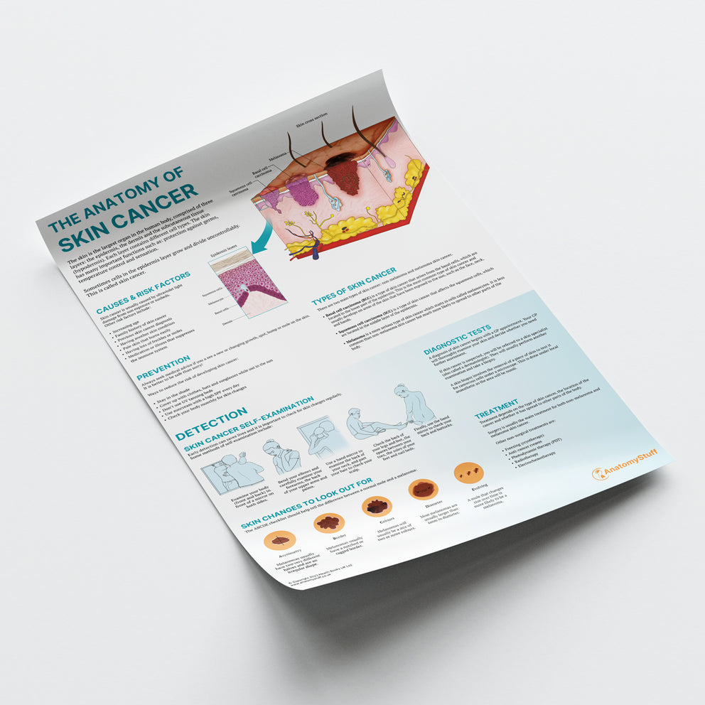 The Anatomy of Skin Cancer Chart | Dermatology Patient Education ...