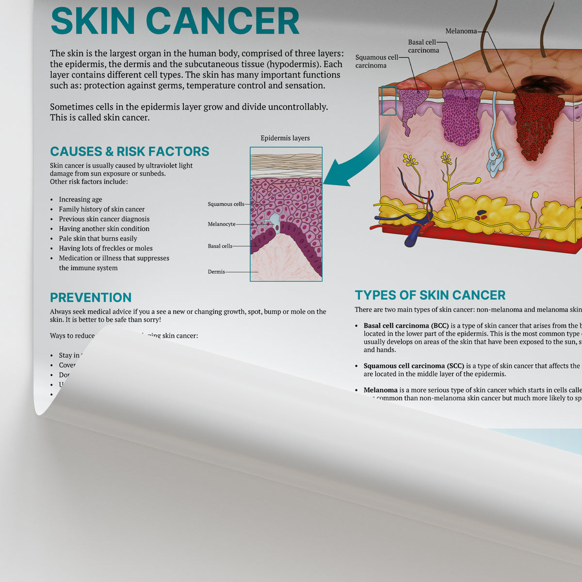 The Anatomy of Skin Cancer Chart | Dermatology Patient Education ...