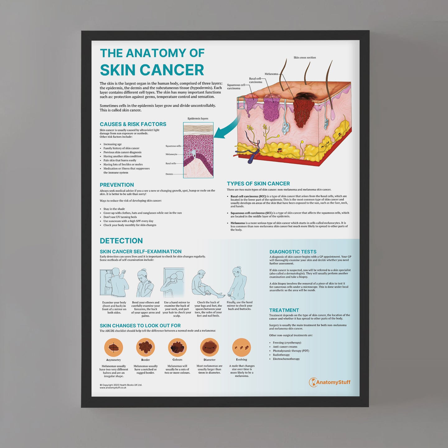 The Anatomy of Skin Cancer Chart | Dermatology Patient Education ...