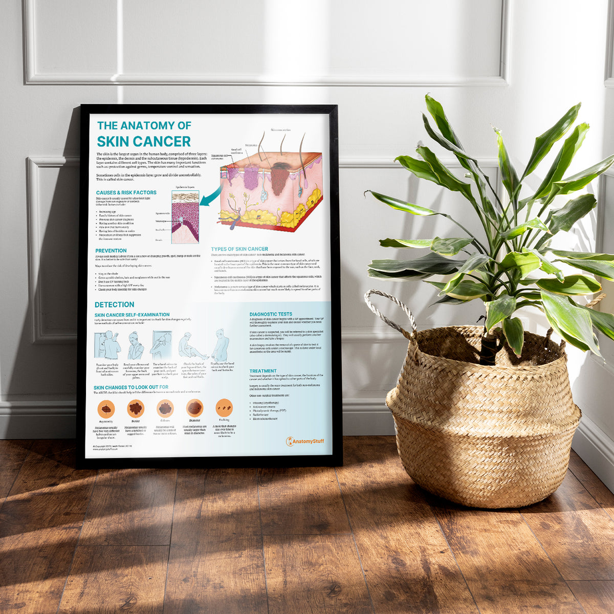 The Anatomy of Skin Cancer Chart | Dermatology Patient Education ...