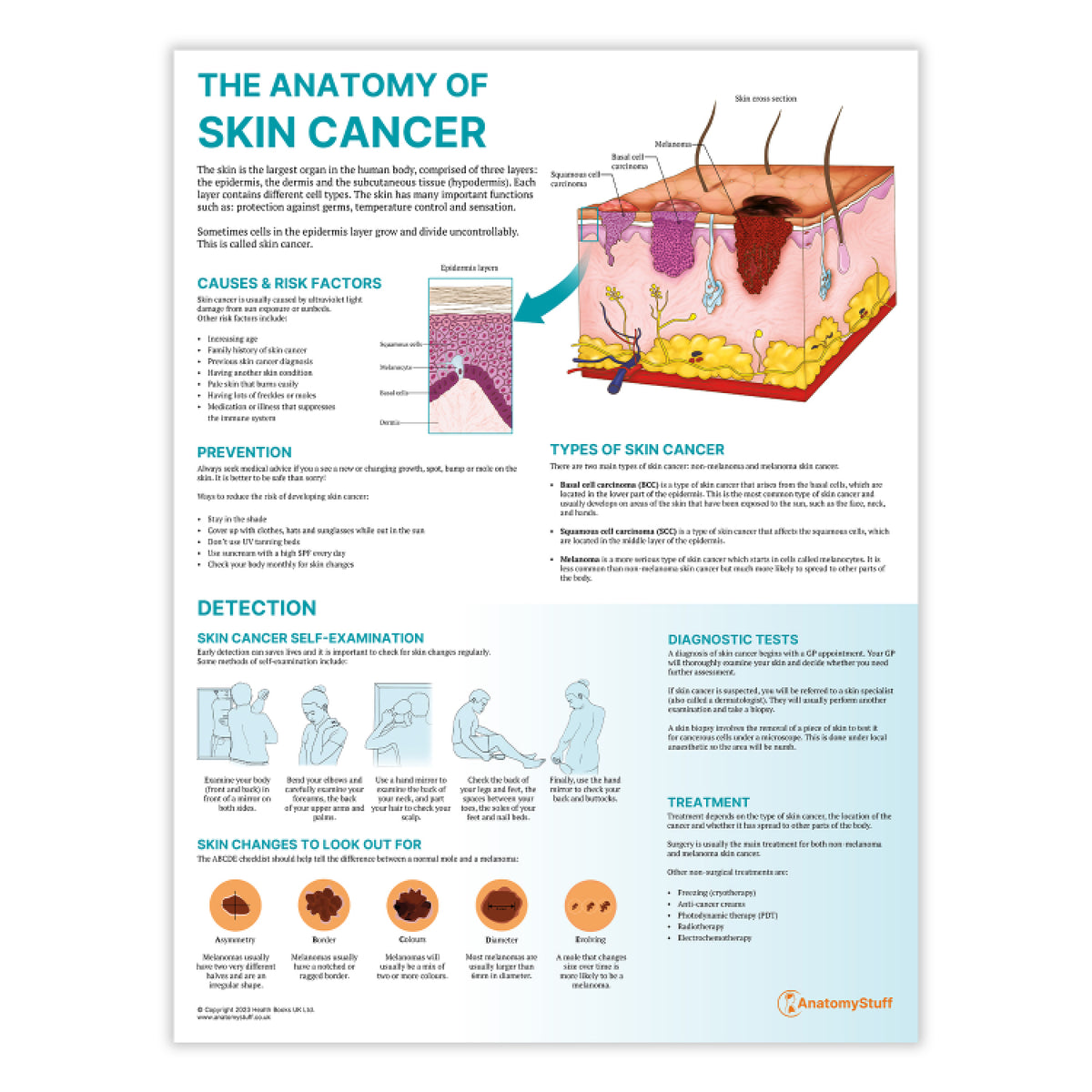 The Anatomy of Skin Cancer Chart | Dermatology Patient Education ...
