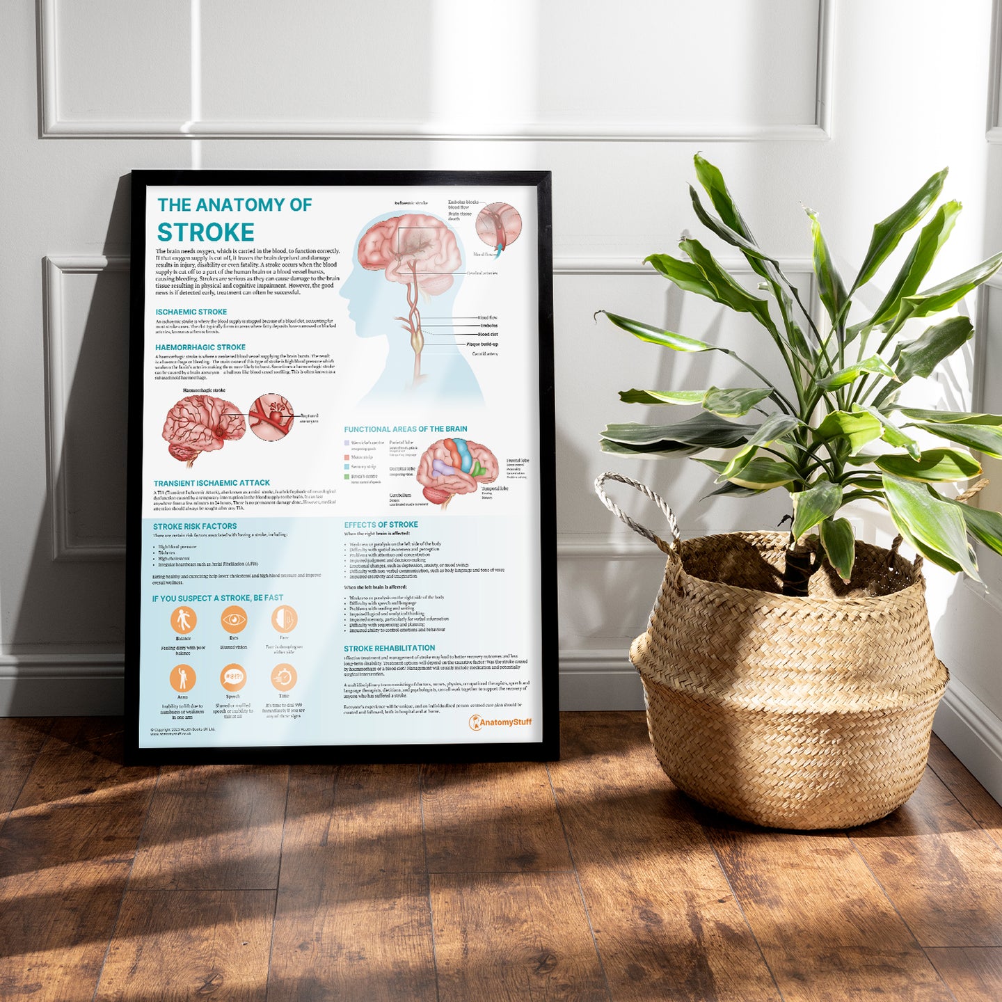 Stroke Brain Poster | Types, Effects & Treatment Education | AnatomyStuff