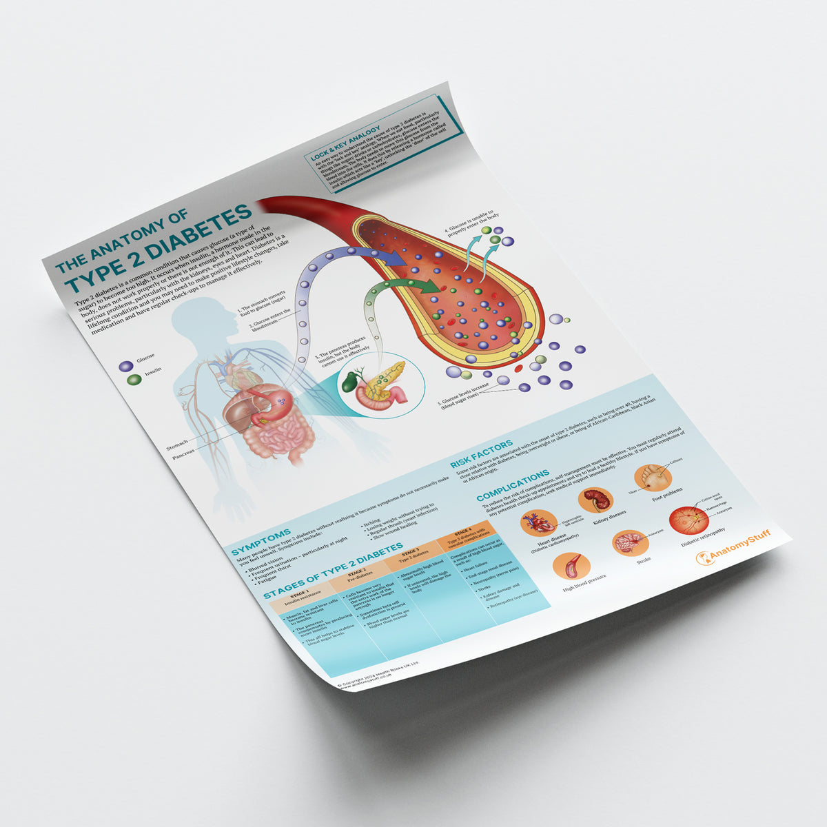 Anatomy of Type 2 Diabetes Chart | Diabetes Education Poster – AnatomyStuff