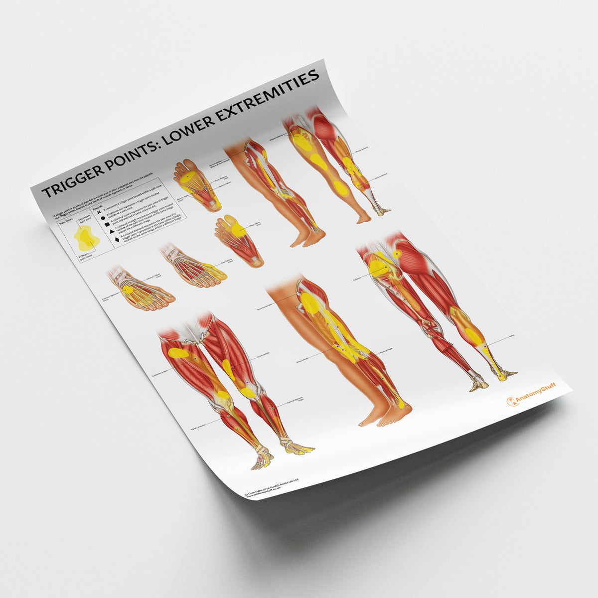 Trigger Points: Lower Extremities Poster | Hip, Knee, Foot Pain Chart ...