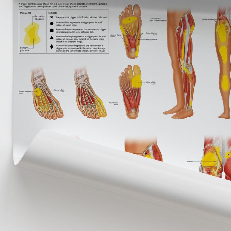 Trigger Points: Lower Extremities Poster | Hip, Knee, Foot Pain Chart ...