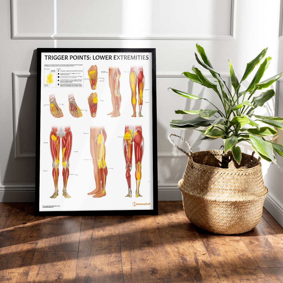 Trigger Points: Lower Extremities Poster | Hip, Knee, Foot Pain Chart ...