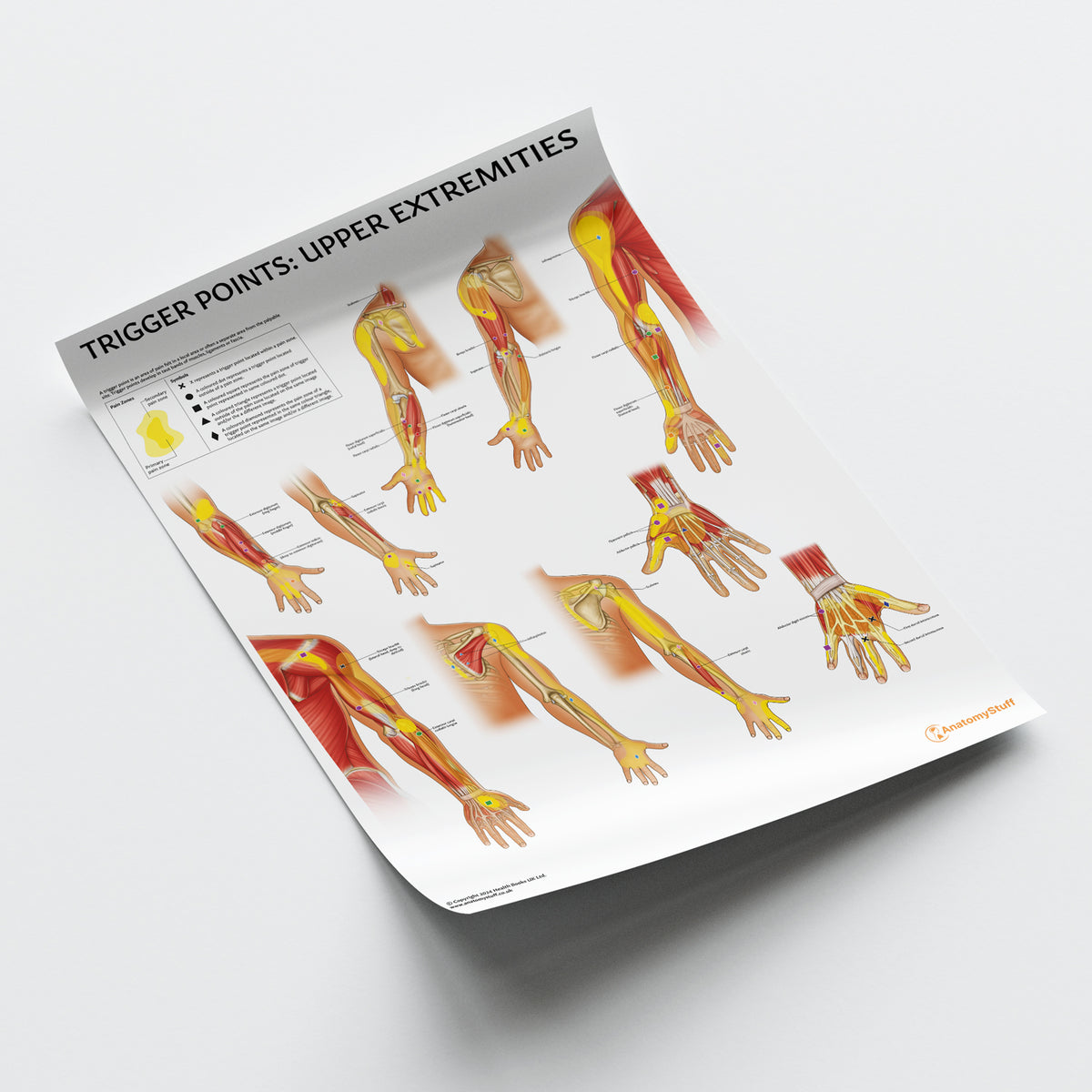 Trigger Points: Upper Extremities Poster | Shoulder, Elbow, Hand Pain ...