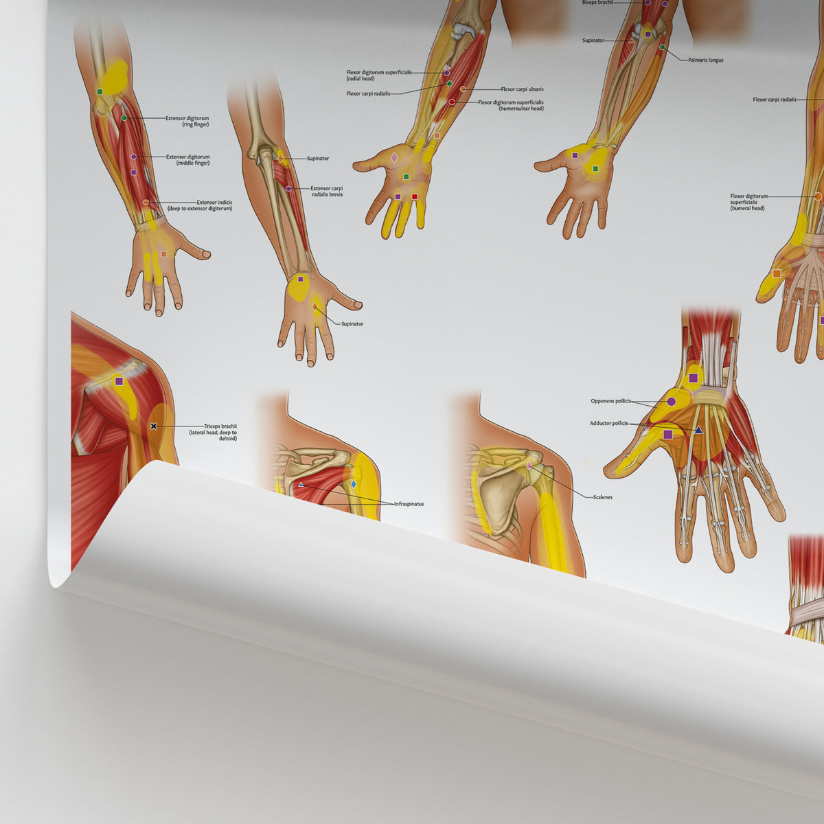 Trigger Points: Upper Extremities Poster | Shoulder, Elbow, Hand Pain ...