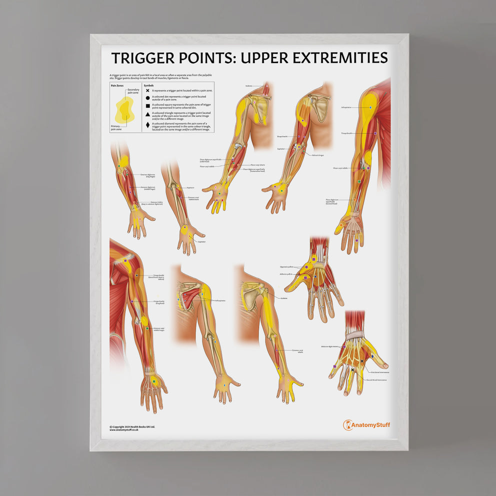 Trigger Points: Upper Extremities Poster | Shoulder, Elbow, Hand Pain ...