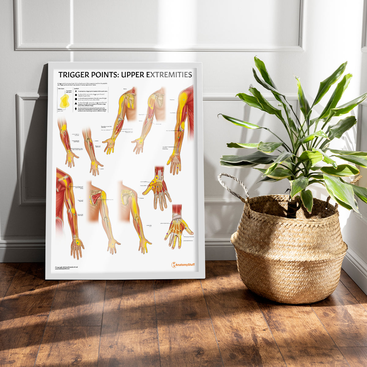 Trigger Points: Upper Extremities Poster | Shoulder, Elbow, Hand Pain ...